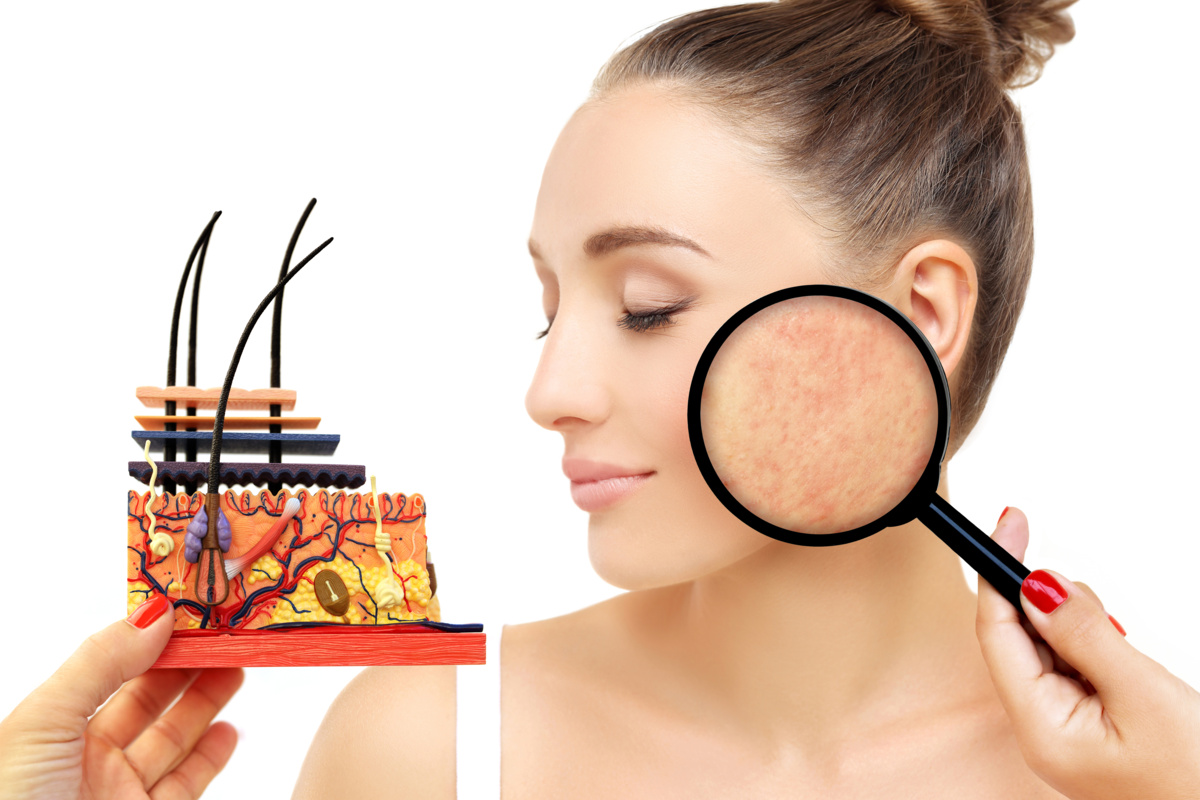 Laser Therapy for Cystic Acne: A New Solution to Severe Breakouts - Spa MD